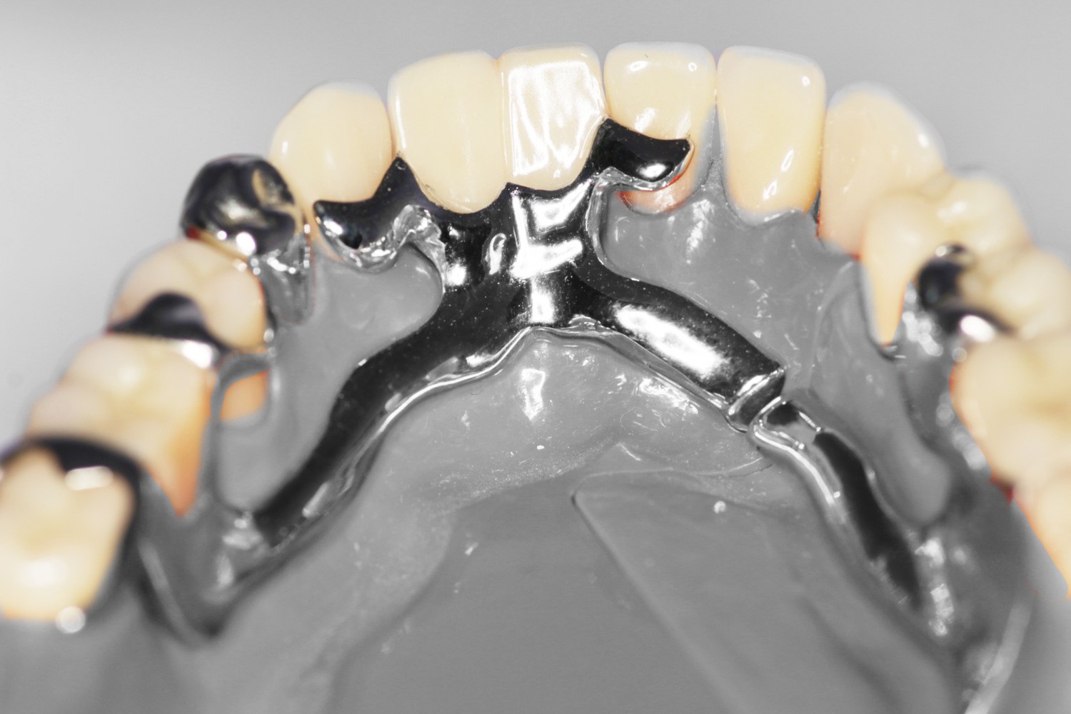 4. Teilprothesen – technoDENT