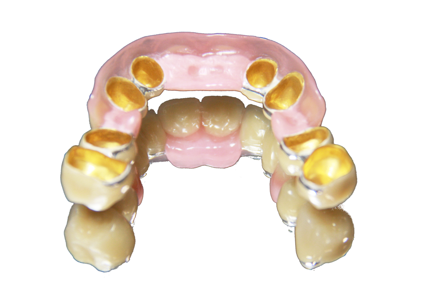 4. Teilprothesen – technoDENT